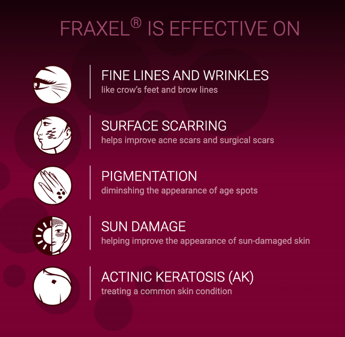 Best Fraxel Laser Packages Brisbane - Cutis Dermatology Best Fraxel Laser Packages Brisbane - Cutis Dermatology